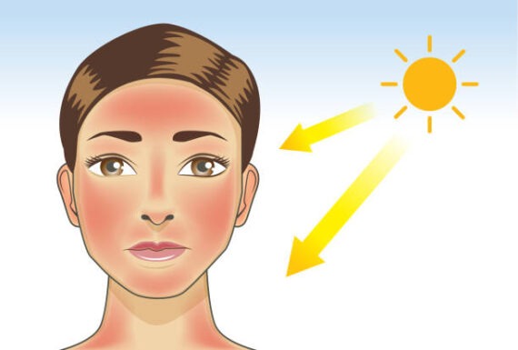 Redness: Causes, Symptoms, and Treatment