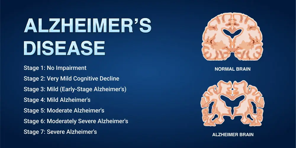 What is Alzheimer? - MEDICINE FOR WORLD