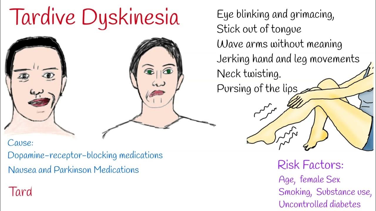 What is Tardive Dyskinesia? - MEDICINE FOR WORLD