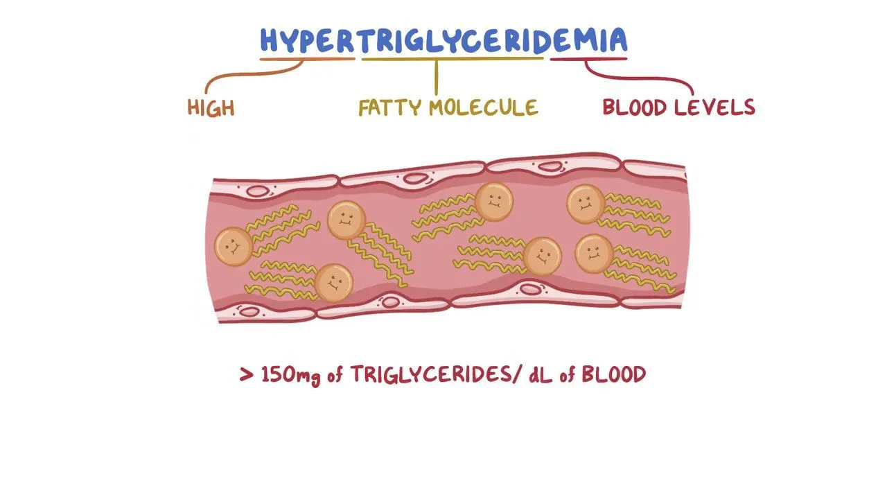 What is Hypertriglyceridemia? - MEDICINE FOR WORLD